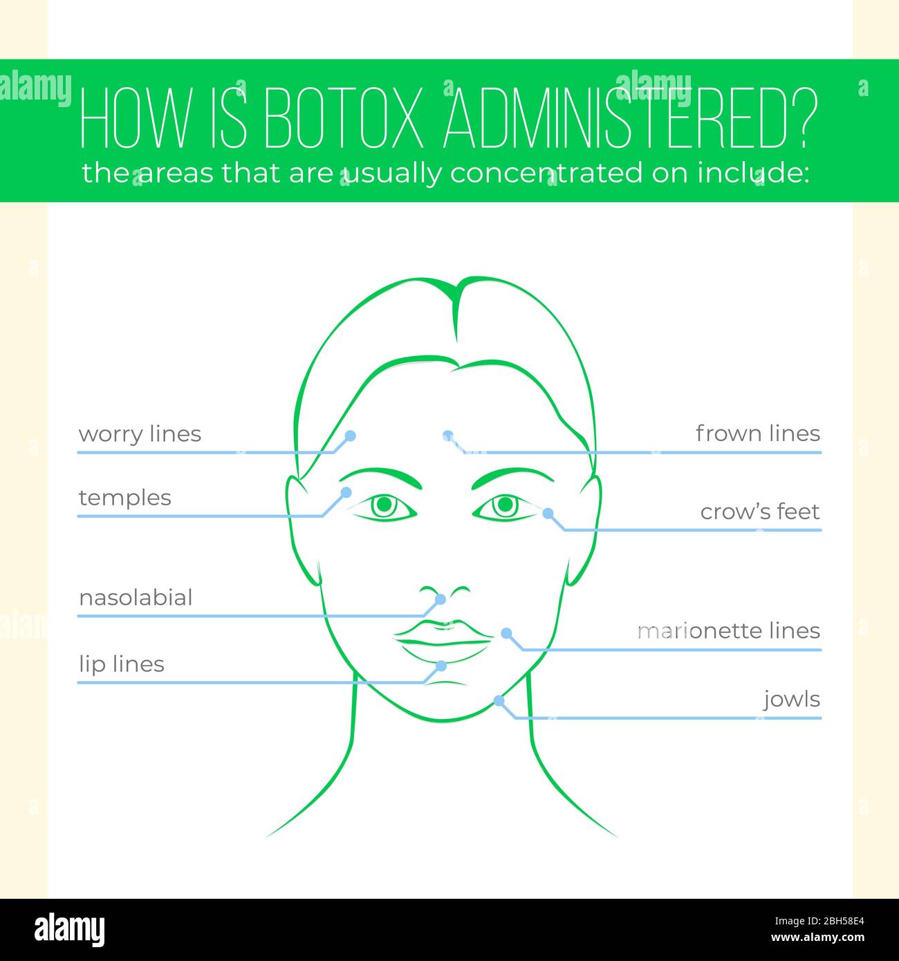 How is Botox Administered. Poster Stock Vector Image & Art - Alamy
