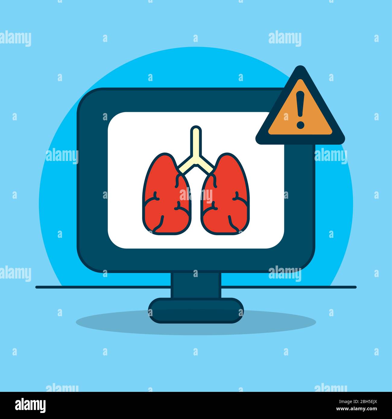 computer monitor with diseased lungs with covid 19 virus over blue ...