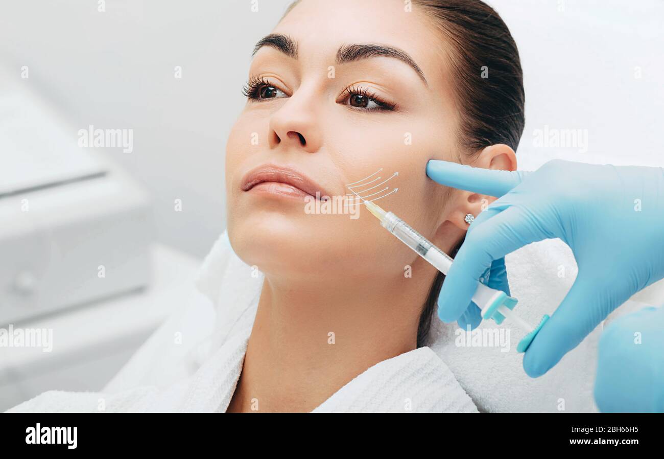 lifting arrows on a female face showing the effect of skin rejuvenation ...