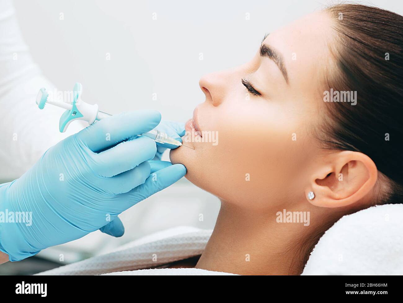 doctor with a syringe of botulinum toxin fills a wrinkle near the mouth ...