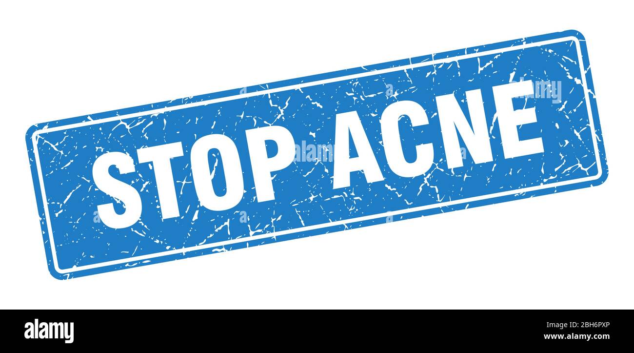 stop acne stamp. stop acne vintage blue label. Sign Stock Vector Image ...
