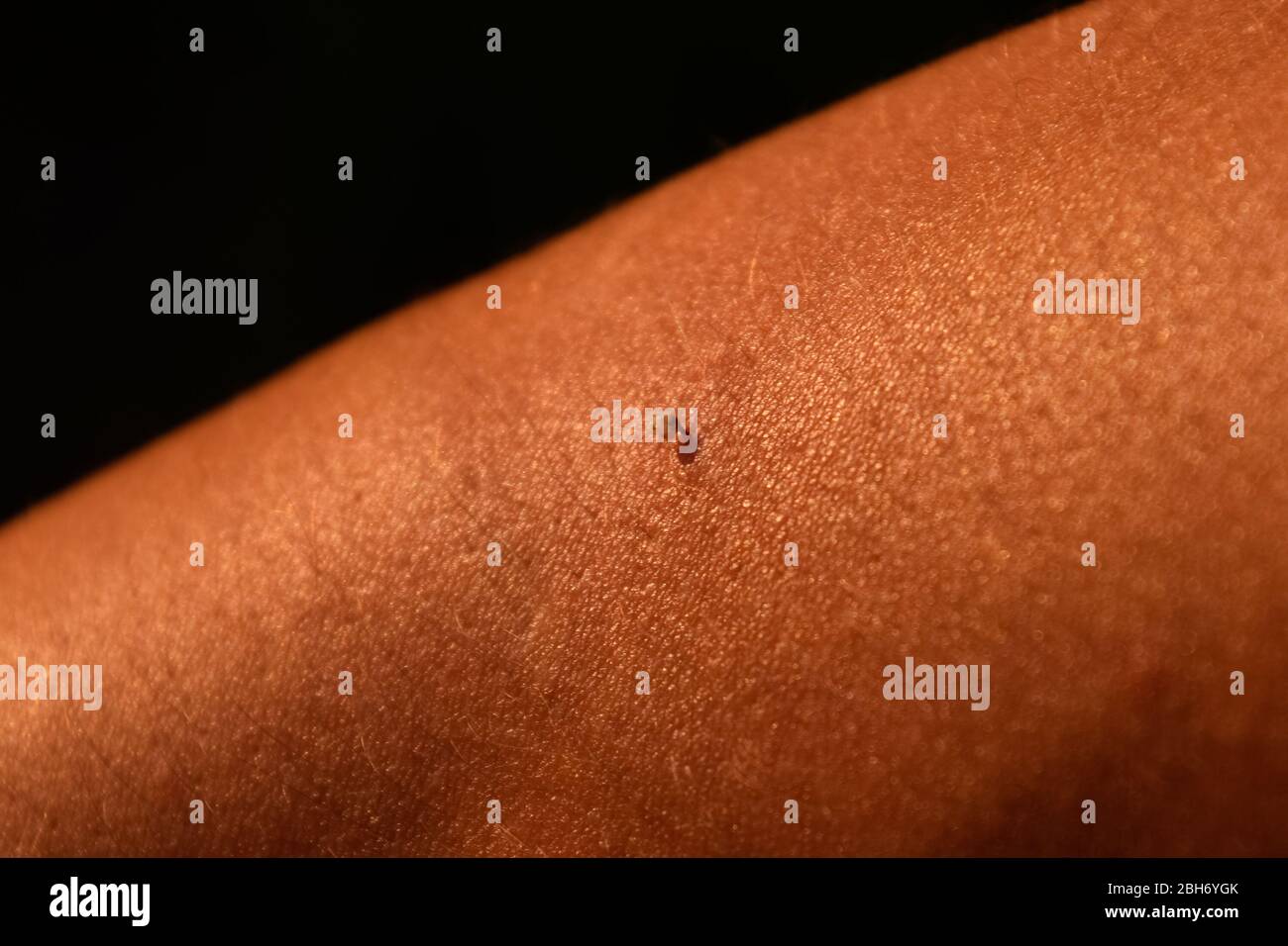 Bee sting skin hi-res stock photography and images - Alamy