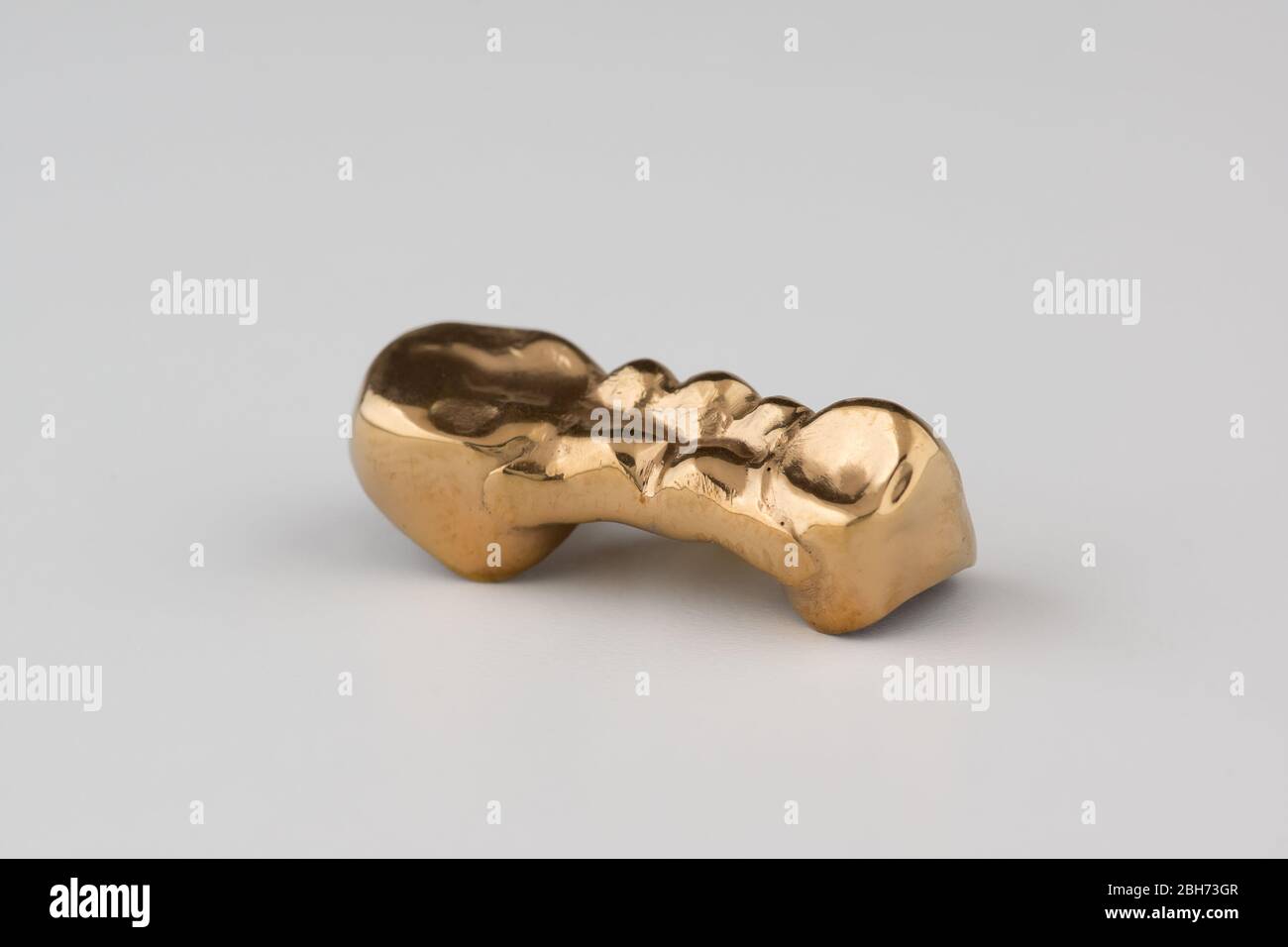 Steel artificial dental crown for dentition restoration Stock Photo - Alamy
