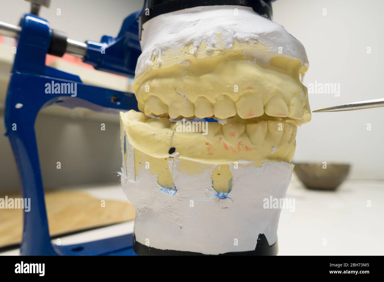 workplace of a dental technician with plaster models in an articulator ...