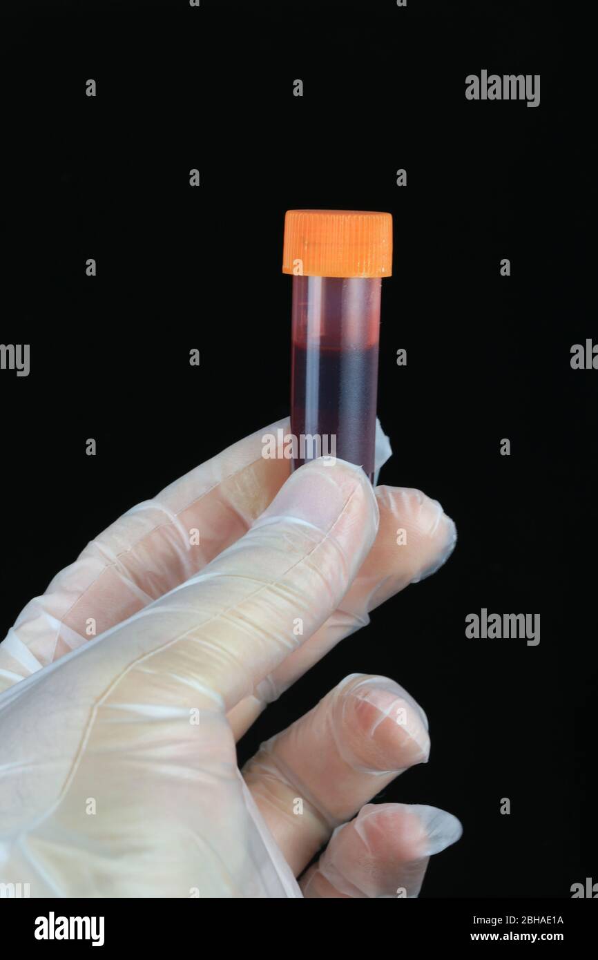 Testing sample vial of human blood Stock Photo - Alamy