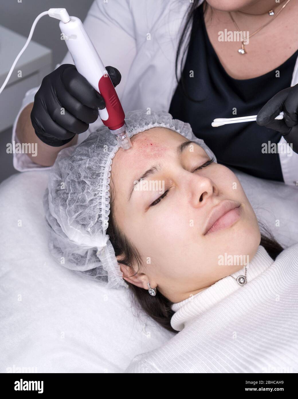 Cosmetologist making mesotherapy injection. Microneedle mesotherapy ...