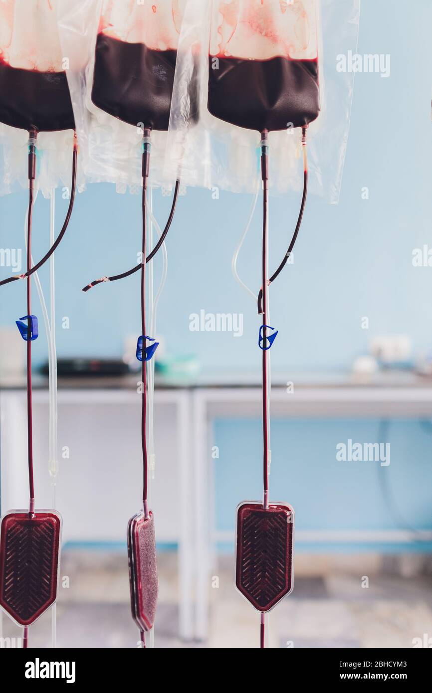 a blood bag for infusion into a clinic. donor blood is administered ...