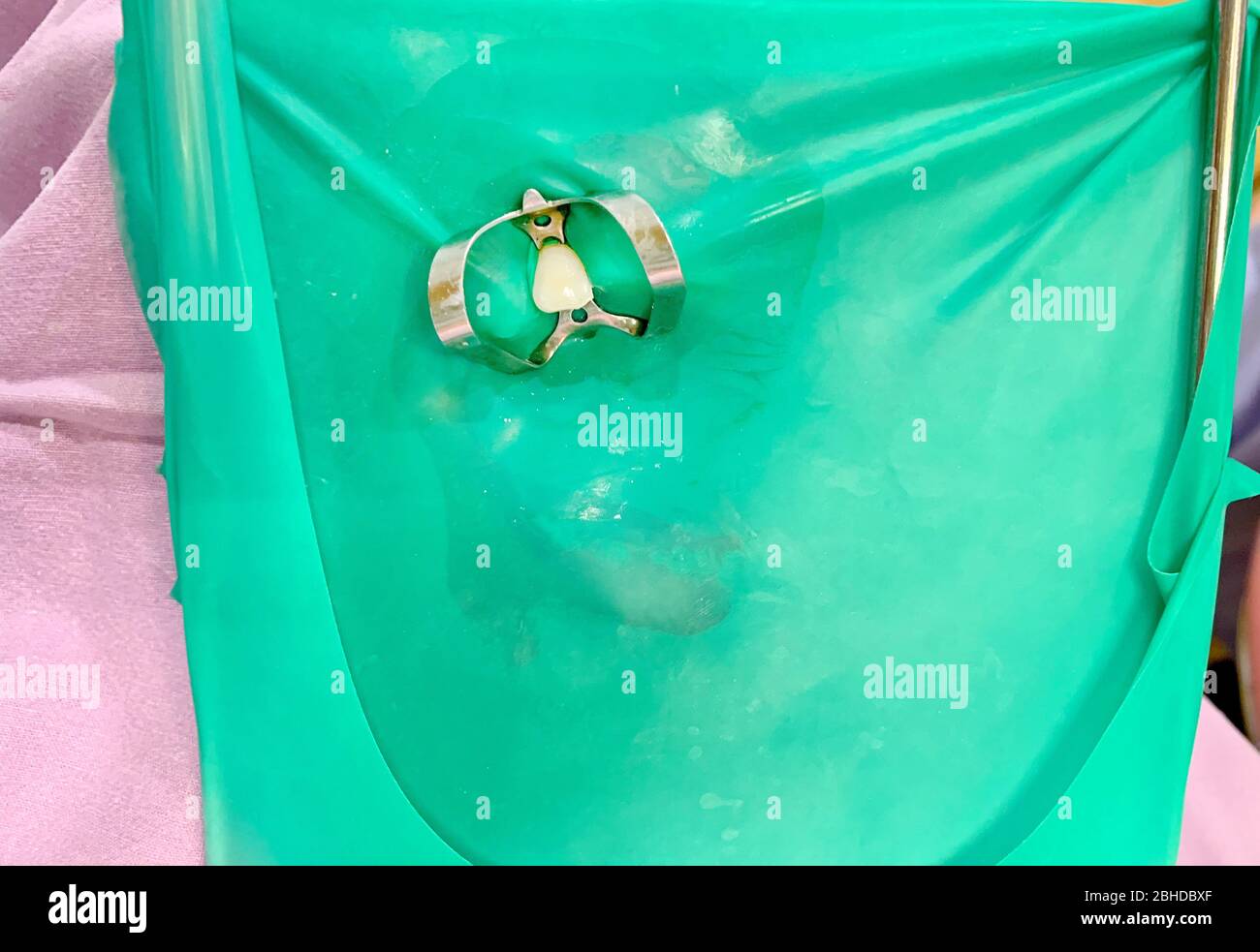 The green rubber dam isolation on tooth with metal clamp for dental ...