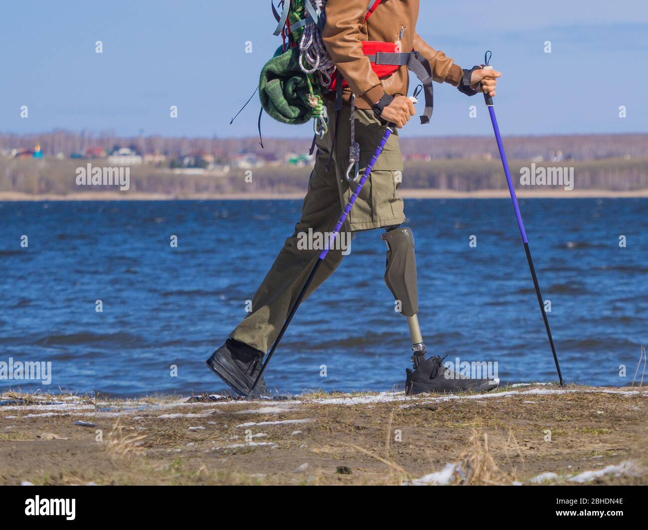 A view of the legs of a running tourist with a prosthetic leg. Active ...