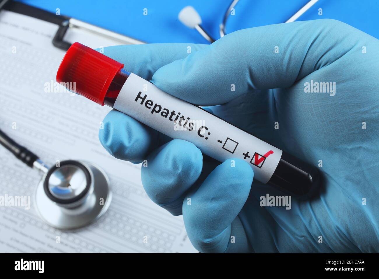 Blood test for hepatitis C. A vacuum tube with blood. Blue background ...