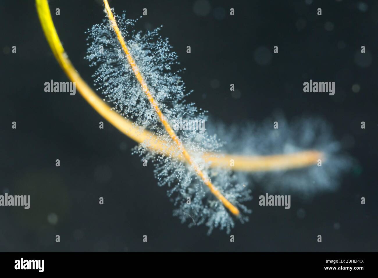 Protozoan colony (Carchesium Stock Photo - Alamy