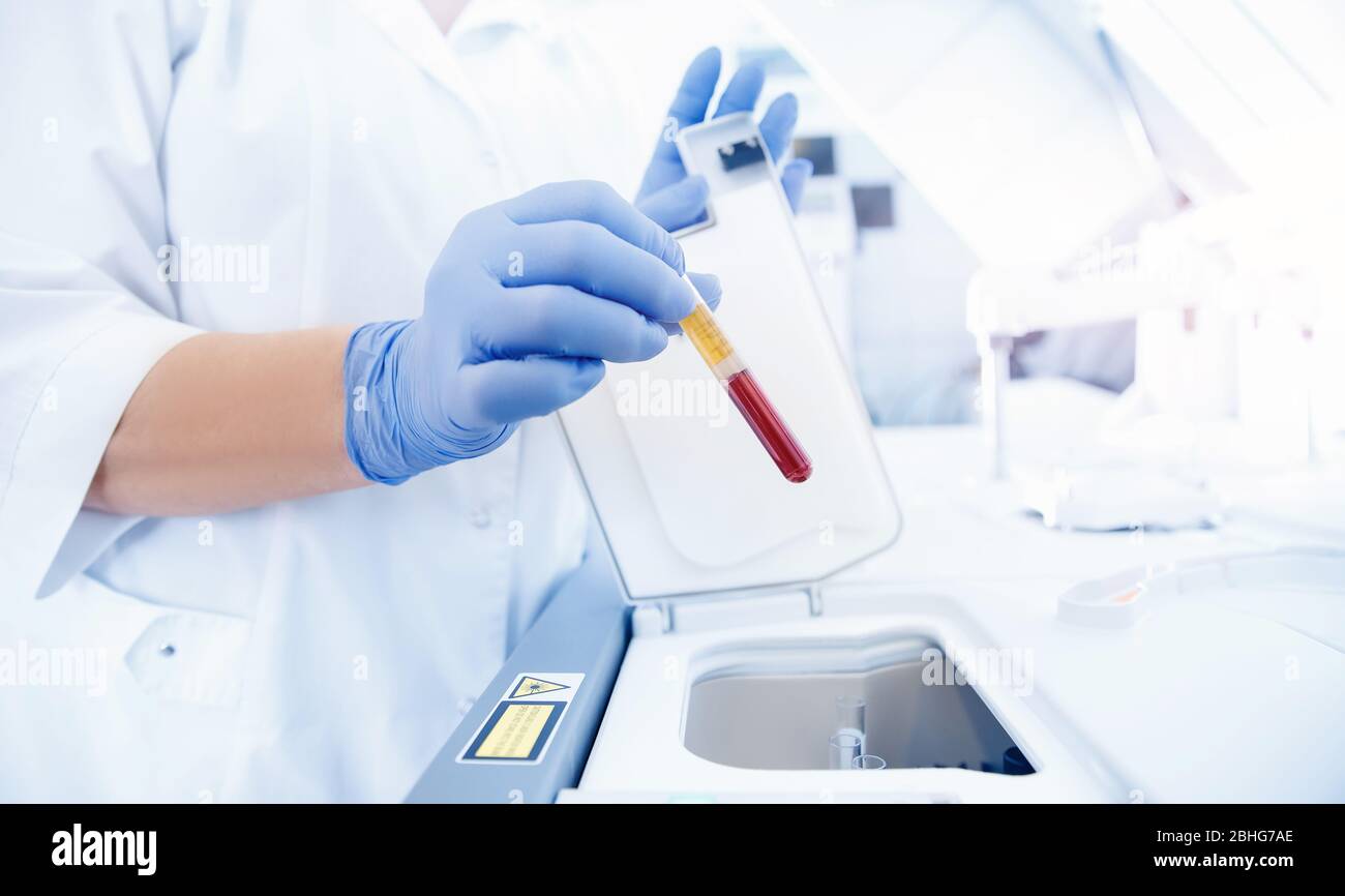 Medical worker in laboratory places blood sample for examination in ...