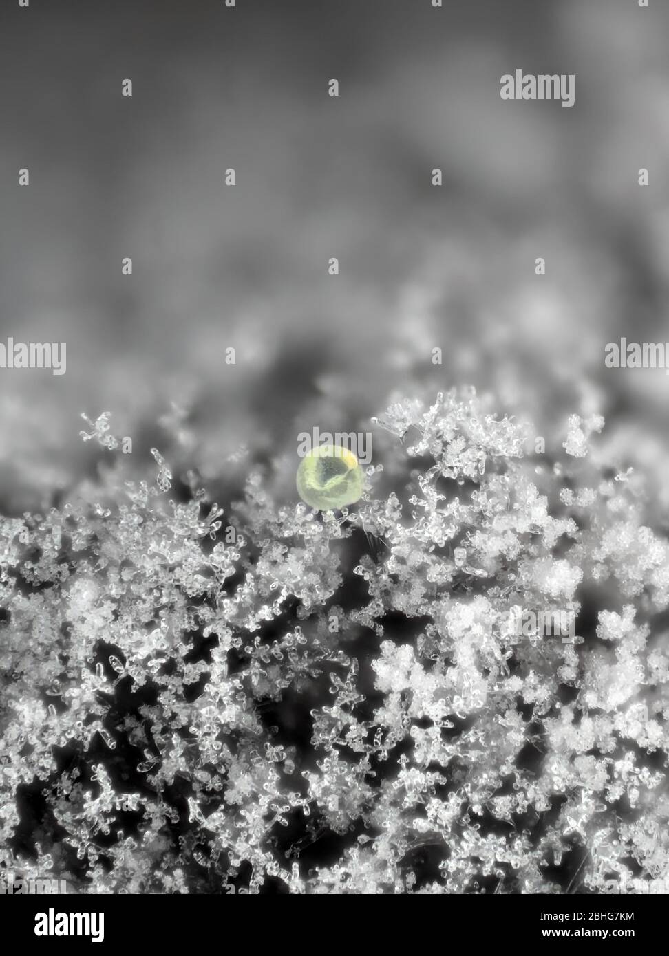 From a soil sample: probably a pollen grain on top of slime mold colony ...