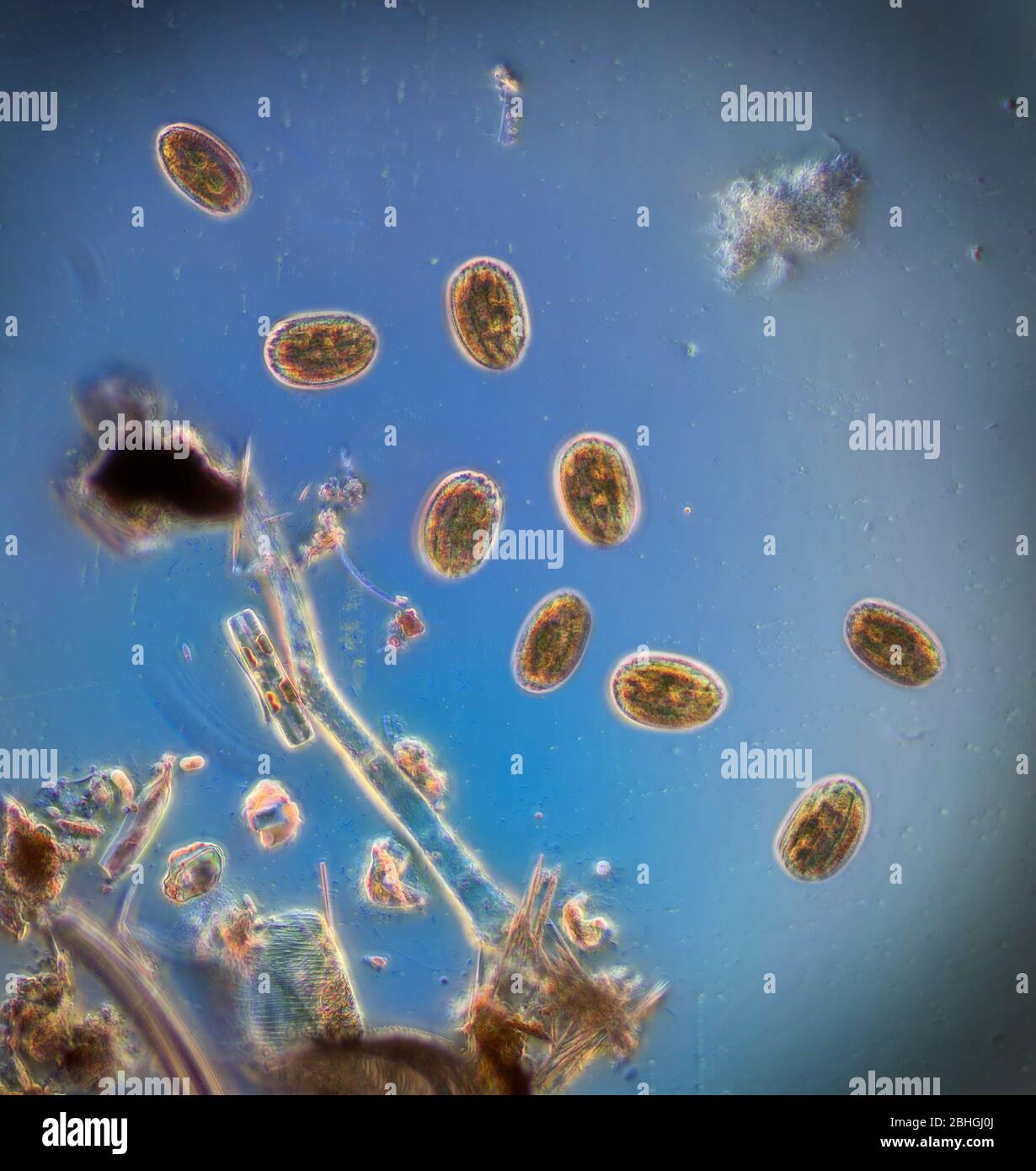Ciliated protozoa hi-res stock photography and images - Alamy