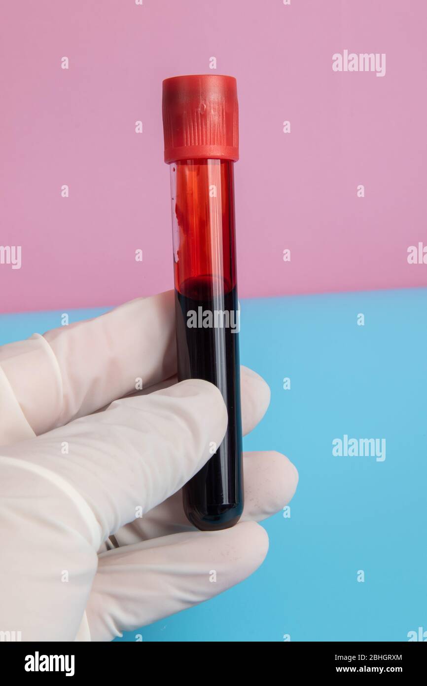 COVID 19 Coronavirus Infected blood sample in the sample tube Stock ...