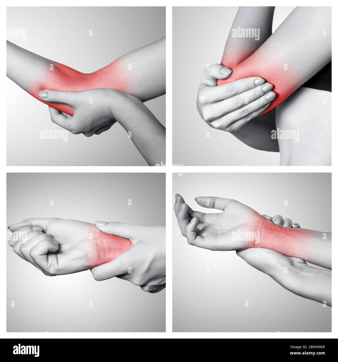 Closeup collage view of pain on human hand. hand, elbow, wrist or arm ...