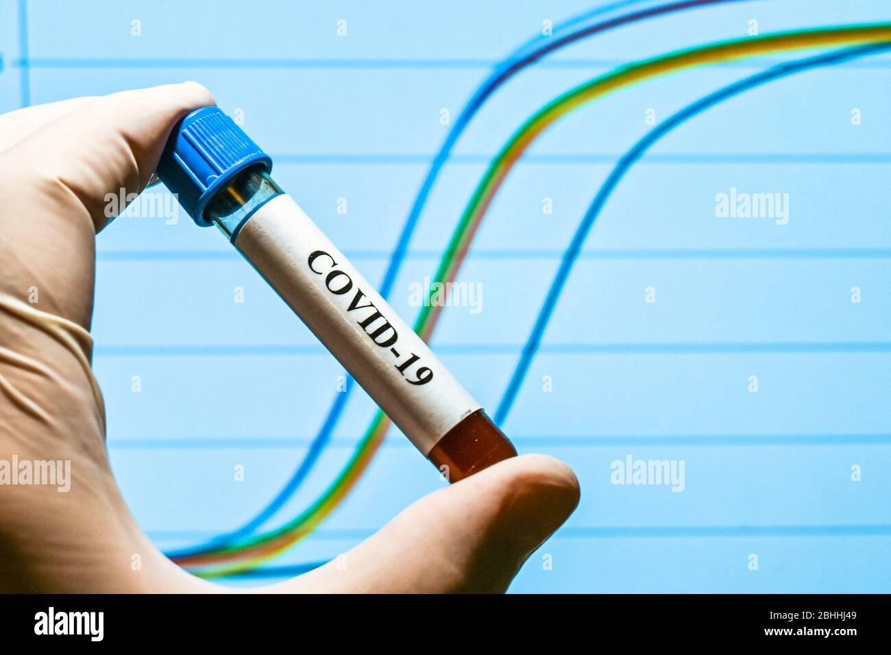 Real-time PCR testing on COVID-19. A test tube with a sample on the ...