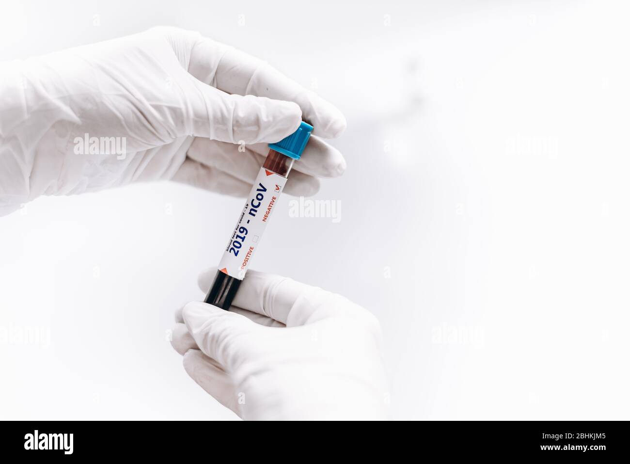 Negative blood test result for the new rapidly spreading Coronavirus ...