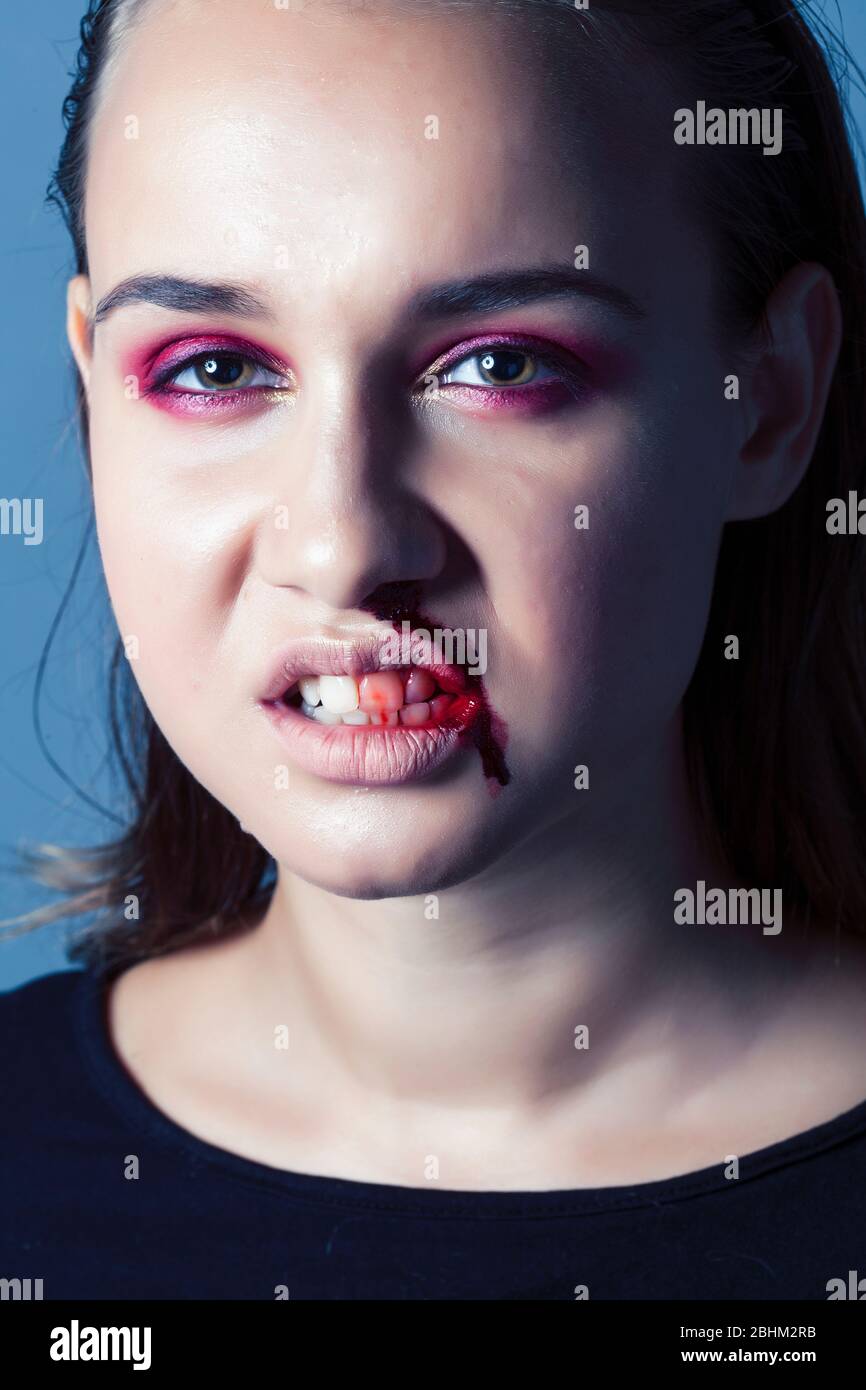 problem depressioned teenager with bleeding nose, real junky close up ...