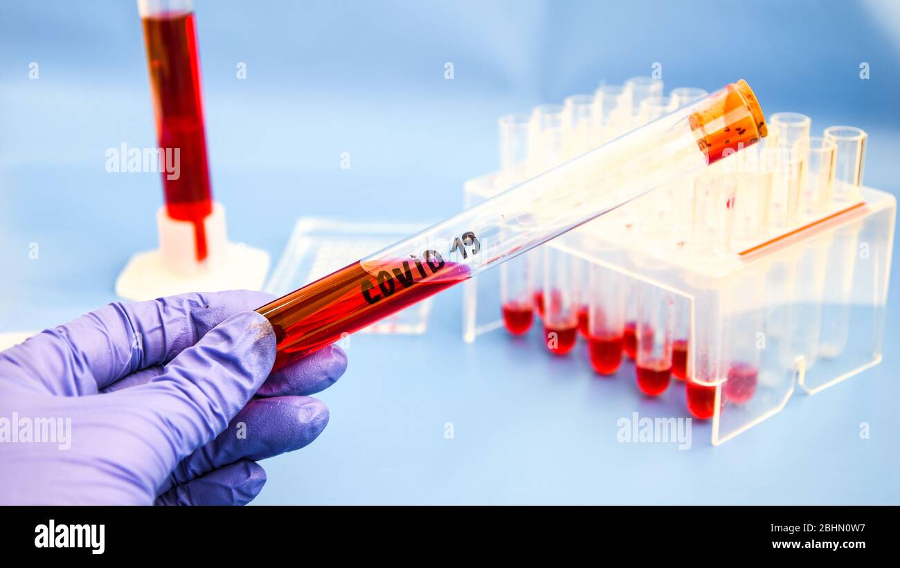 Blood sample collection hi-res stock photography and images - Alamy