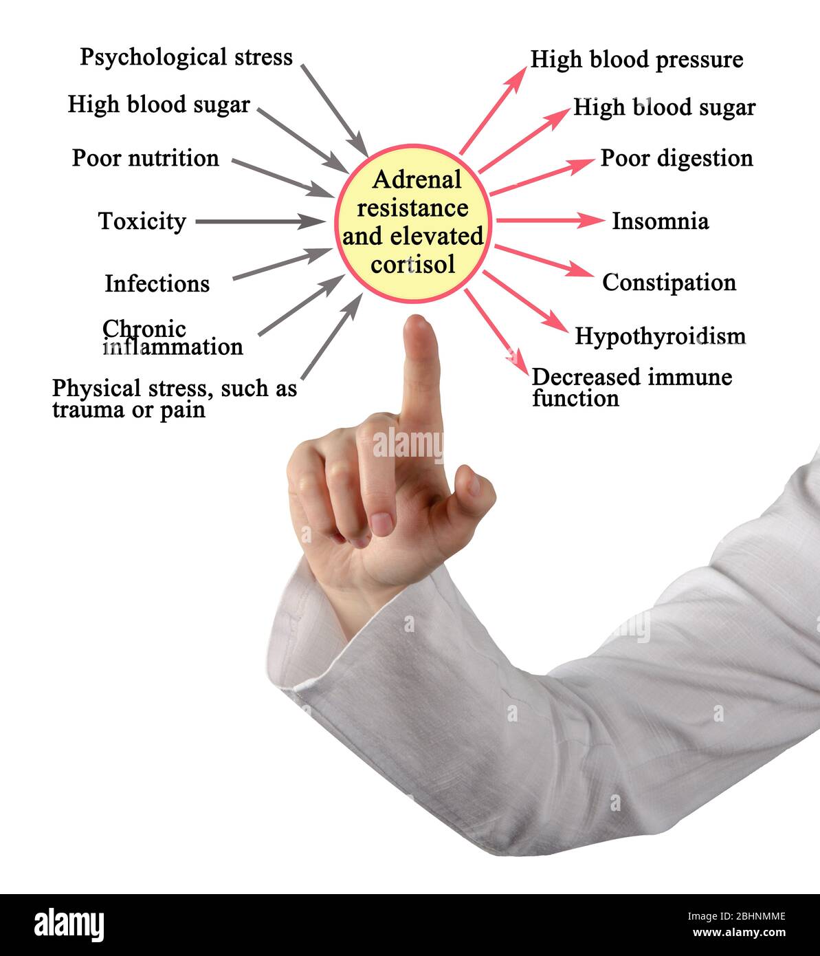 Adrenal resistance and elevated cortisol Stock Photo - Alamy