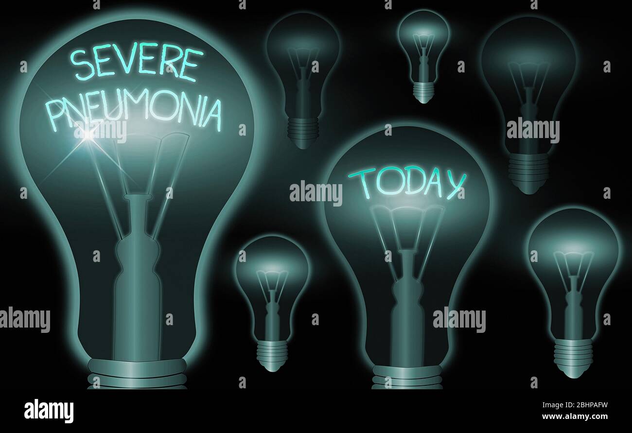 Handwriting text writing Severe Pneumonia. Conceptual photo acute ...
