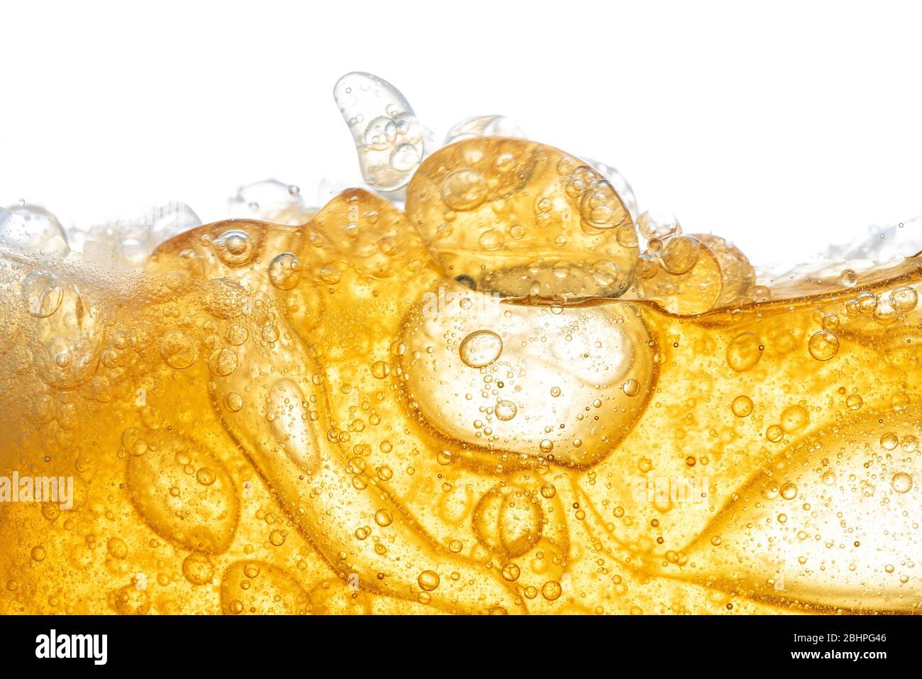 Yellow fat, like obesity cells, under the microscope, is a chemical ...