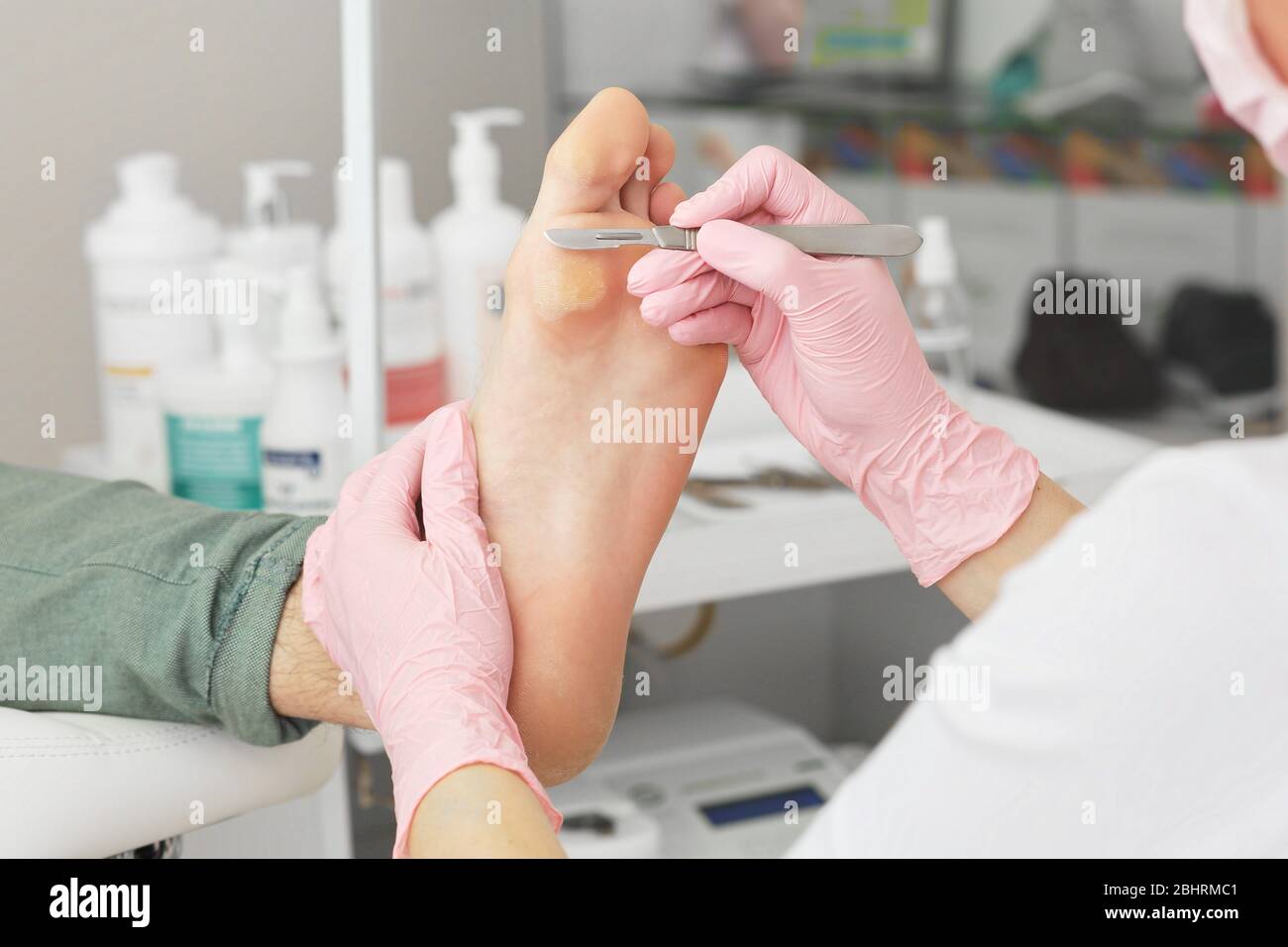 Professional pedicure using dieffenbach scalpel.Patient visiting ...
