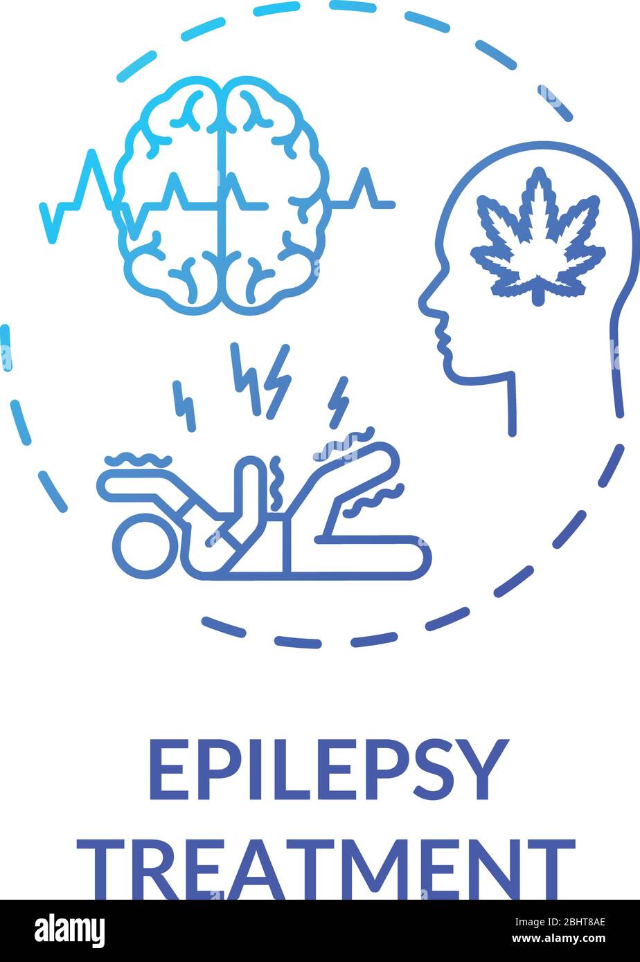 Epilepsy Treatment
