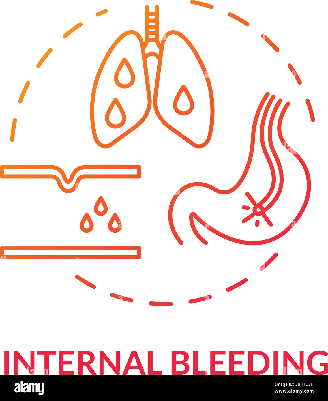 Arterial bleeding hi-res stock photography and images - Alamy