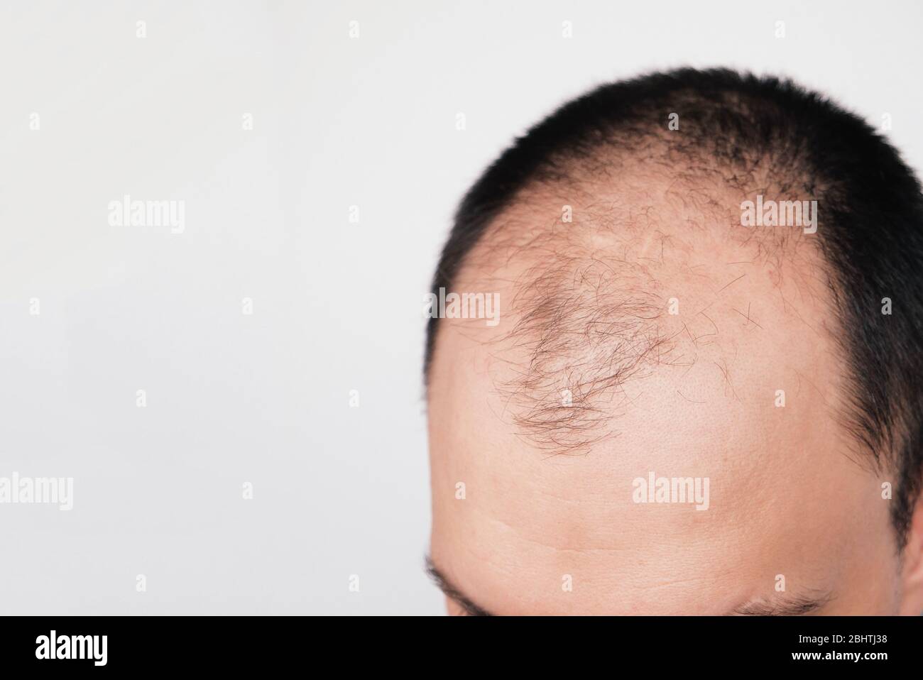 Man bald at the temples hi-res stock photography and images - Alamy