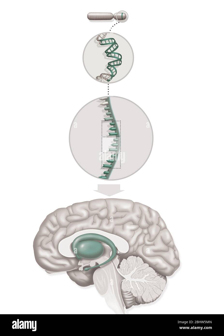 Huntington chorea hi-res stock photography and images - Alamy