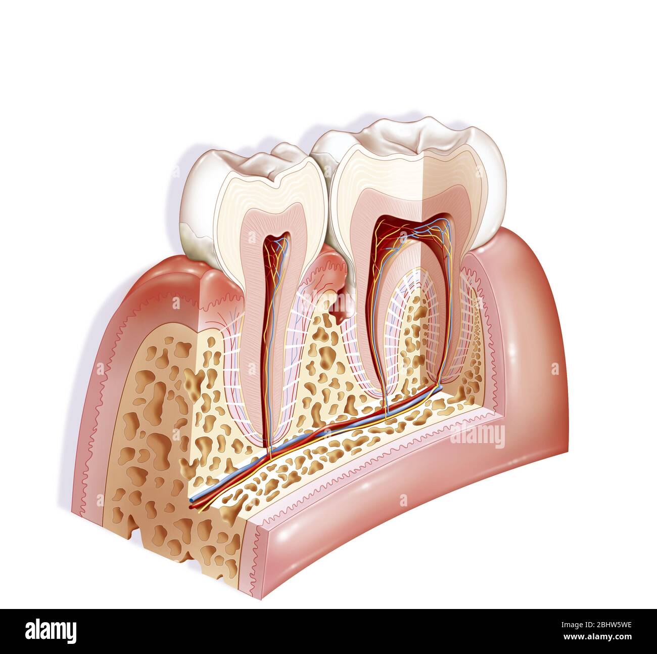 Periodontitis is an inflammation of the periodontium. The periodontium ...