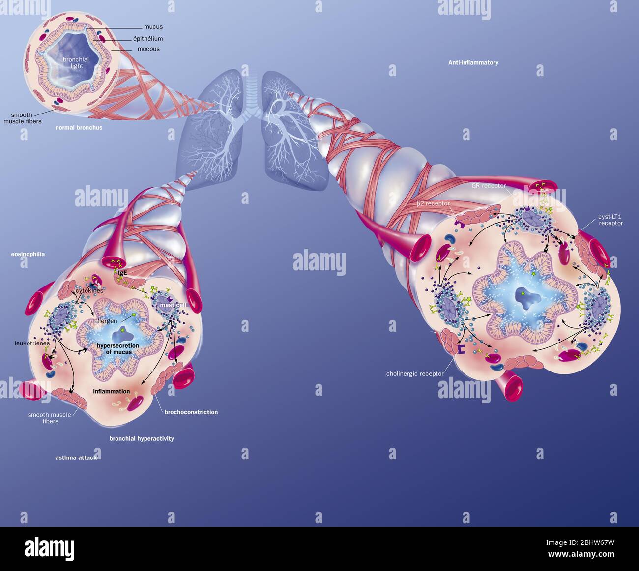 Asthma and its treatments. Representation of the lungs with the ...