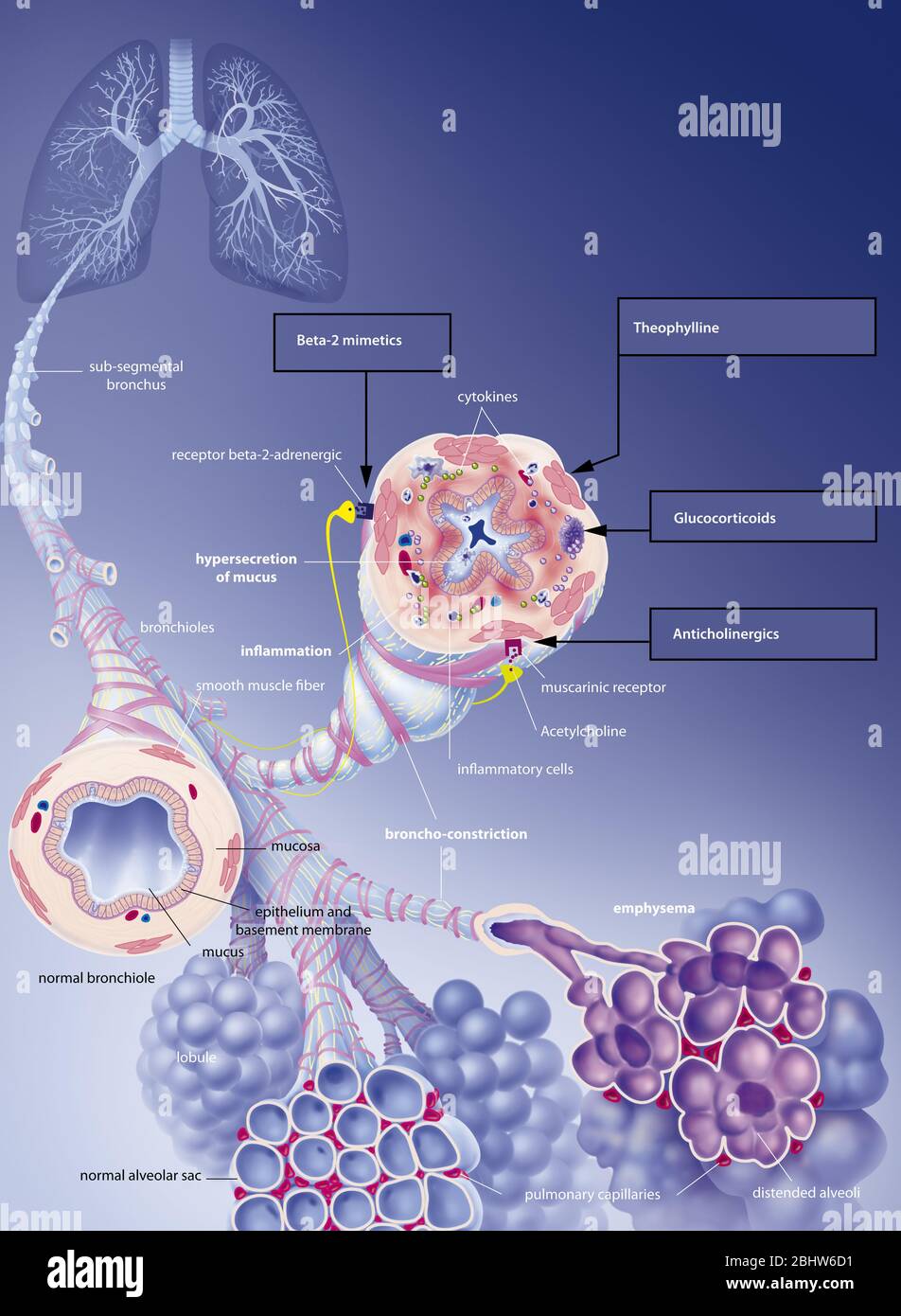 Chronic obstructive pulmonary disease COPD and its treatments. In the ...