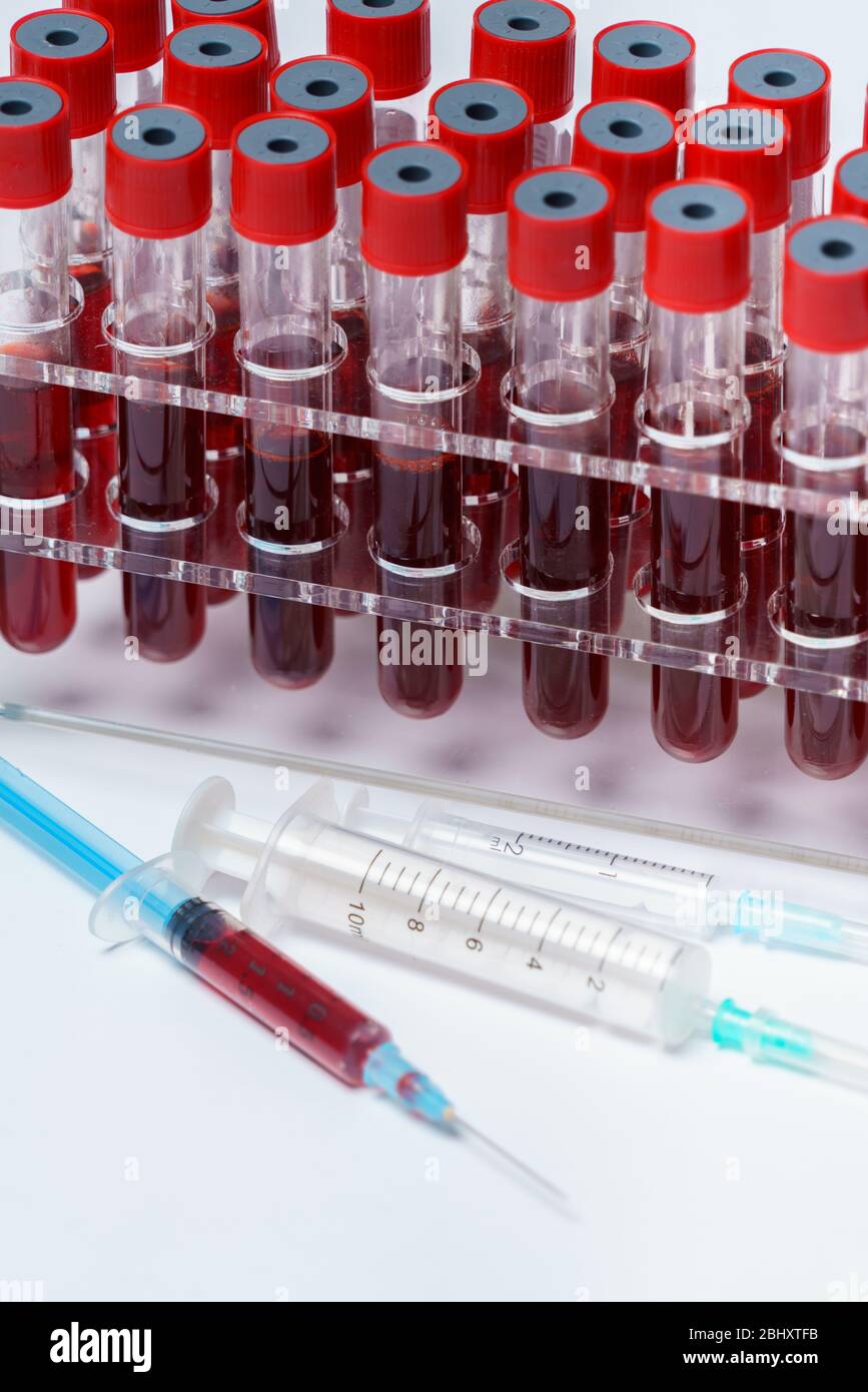 Rack of Tubes of blood sample for testing biological material Stock ...