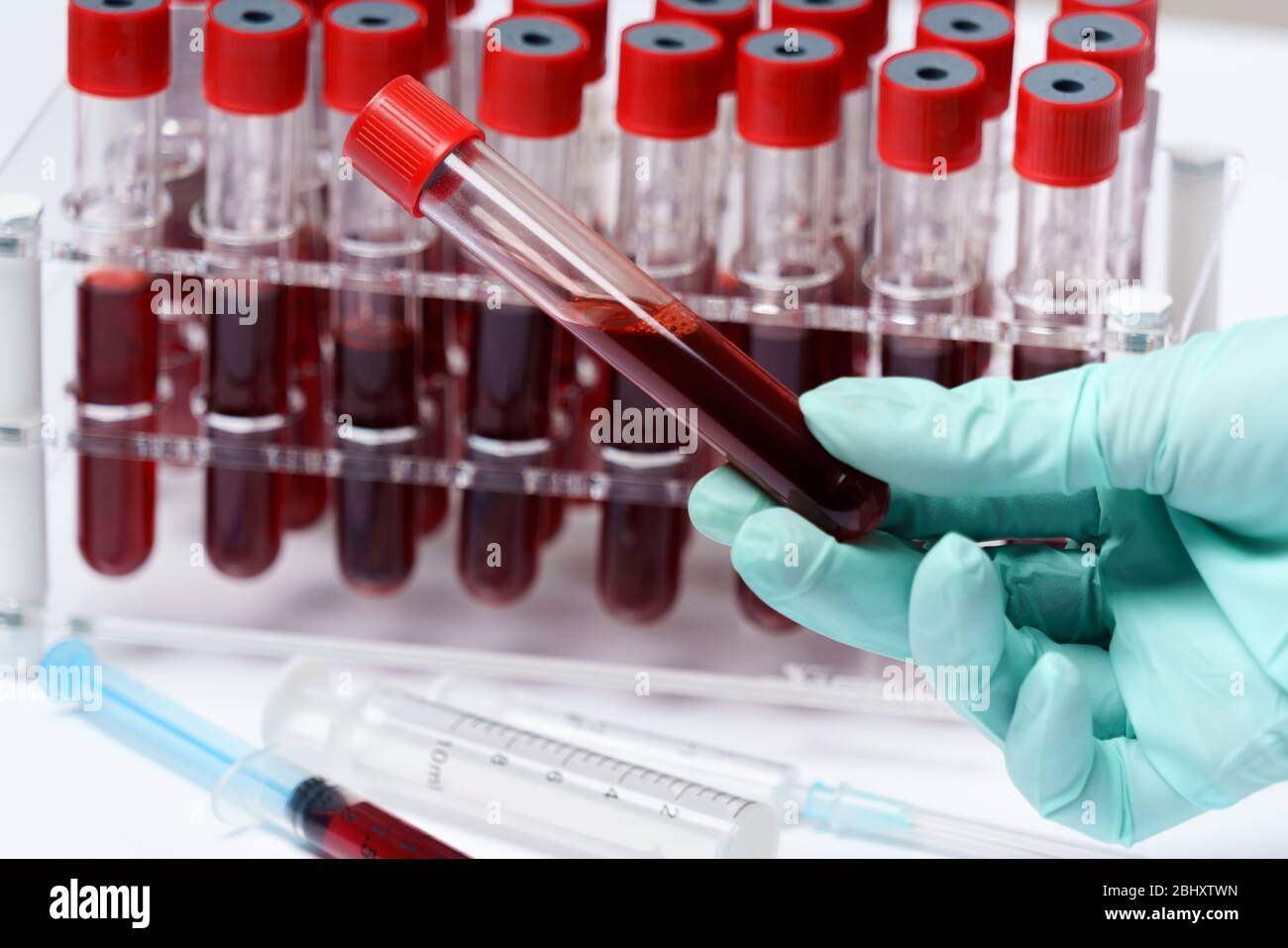 Rack of Tubes of blood sample for testing biological material Stock ...