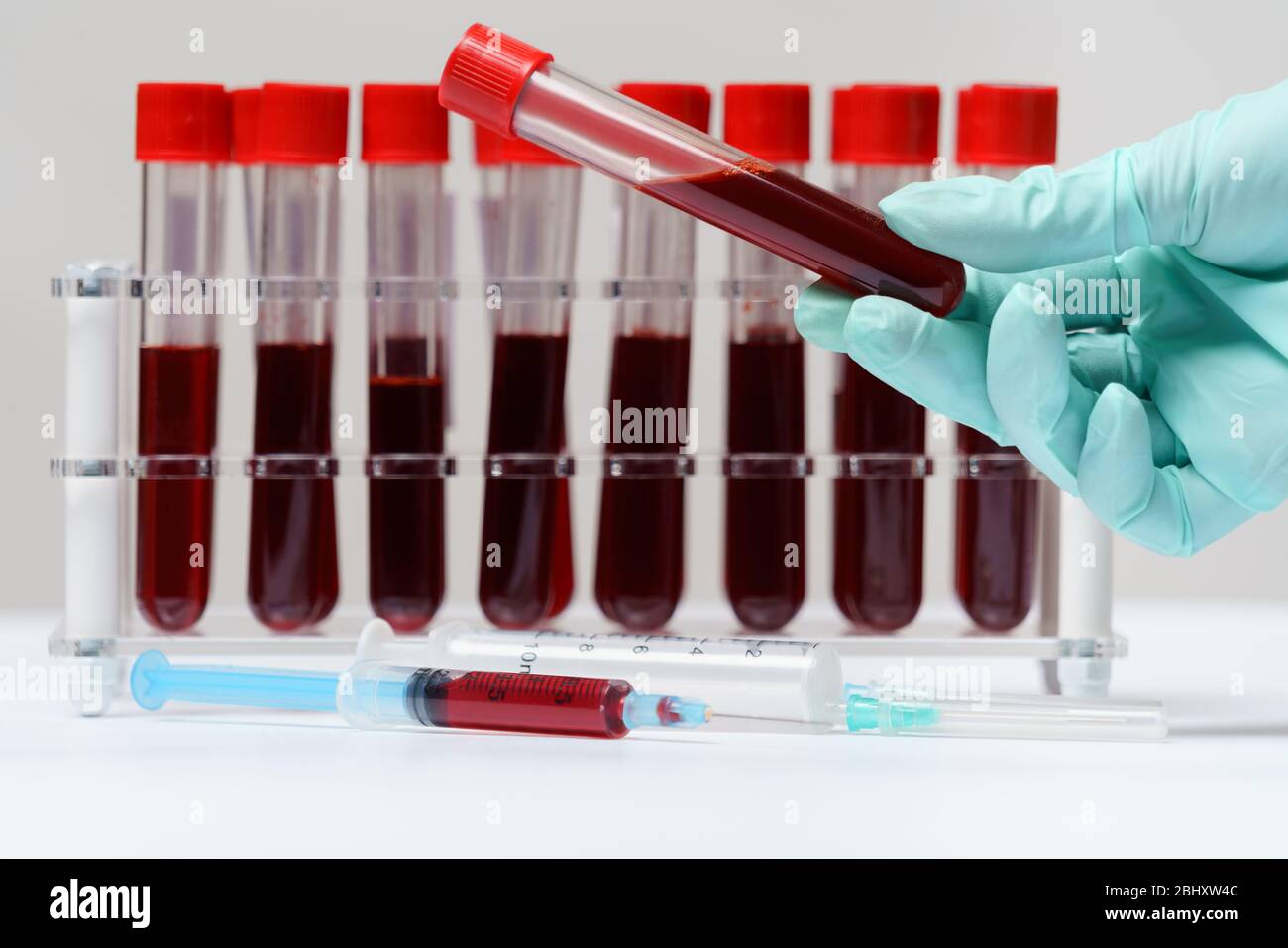 Rack of Tubes of blood sample for testing biological material Stock ...