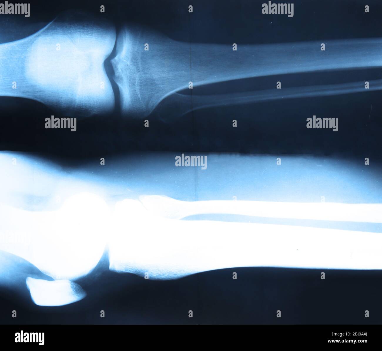 Human knees hi-res stock photography and images - Alamy