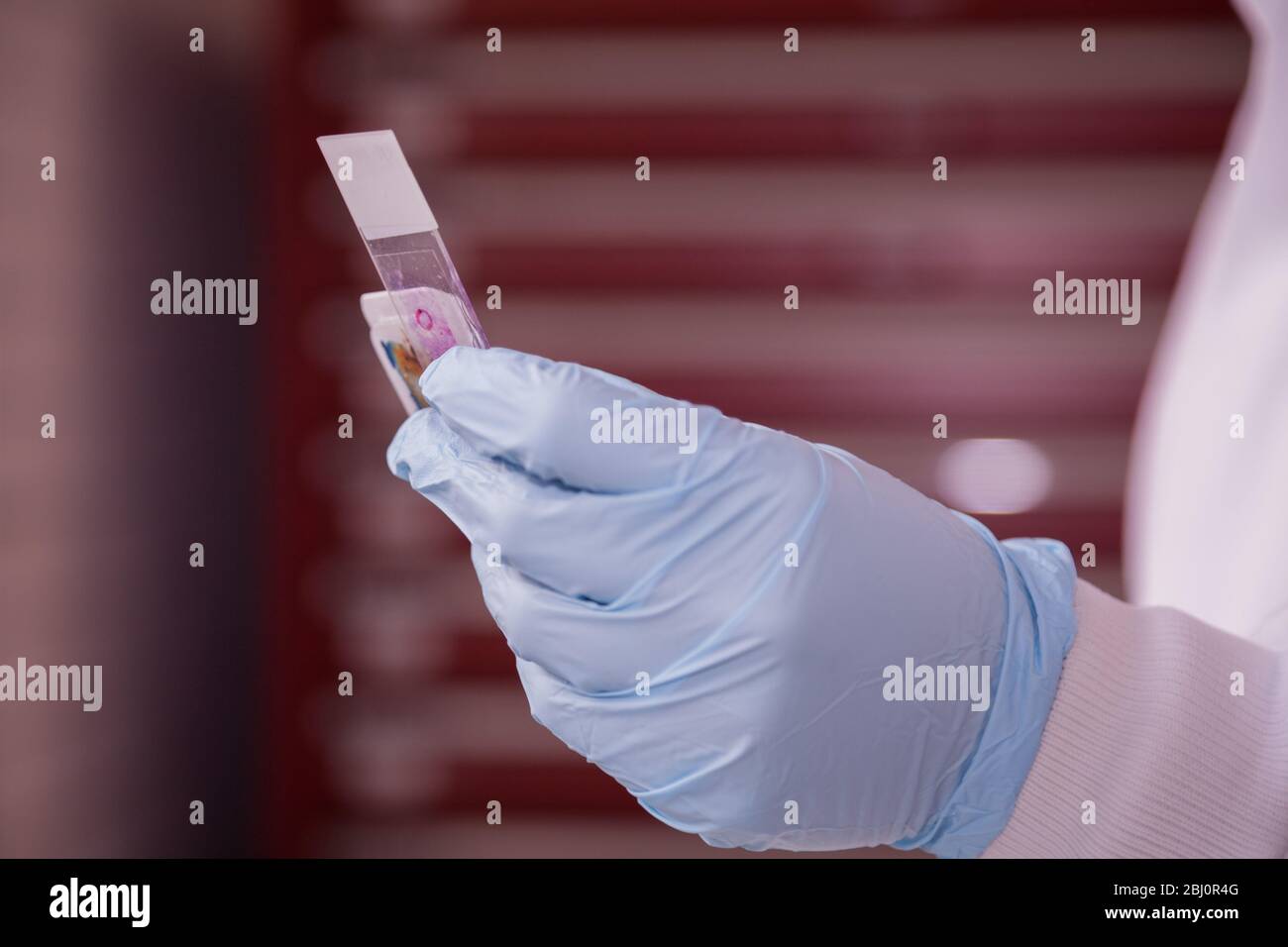 Glass medical sample slides Stock Photo - Alamy