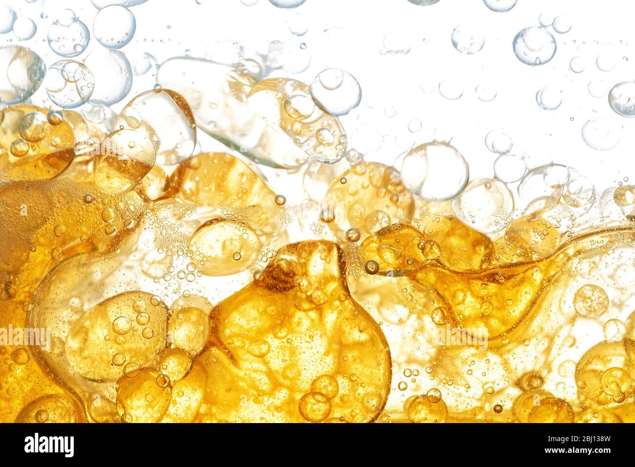 Yellow fat, like obesity cells, under the microscope, is a chemical ...