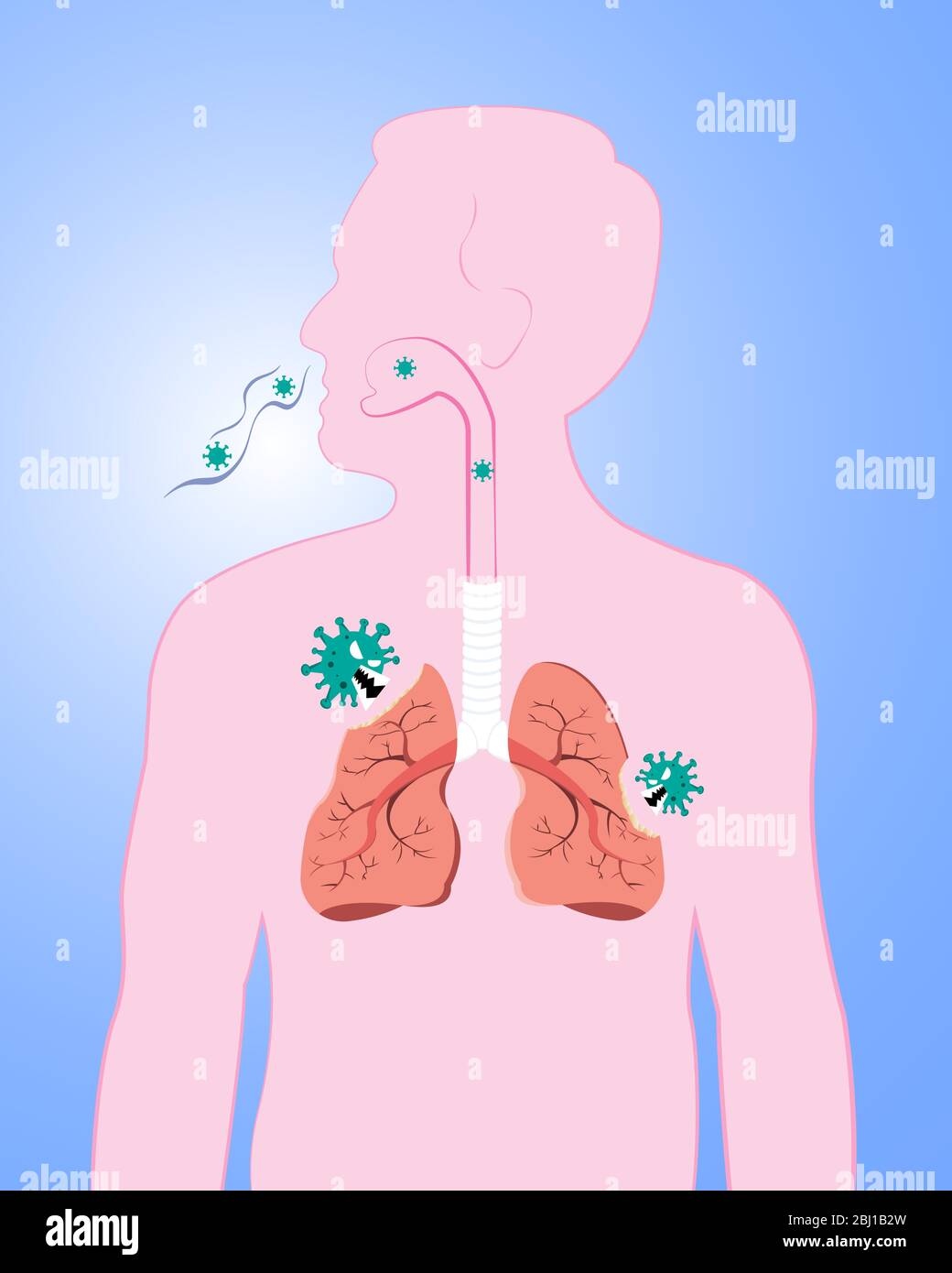 Damaged from virus cells biting lung. Coronavirus (COVID-19) with scary ...