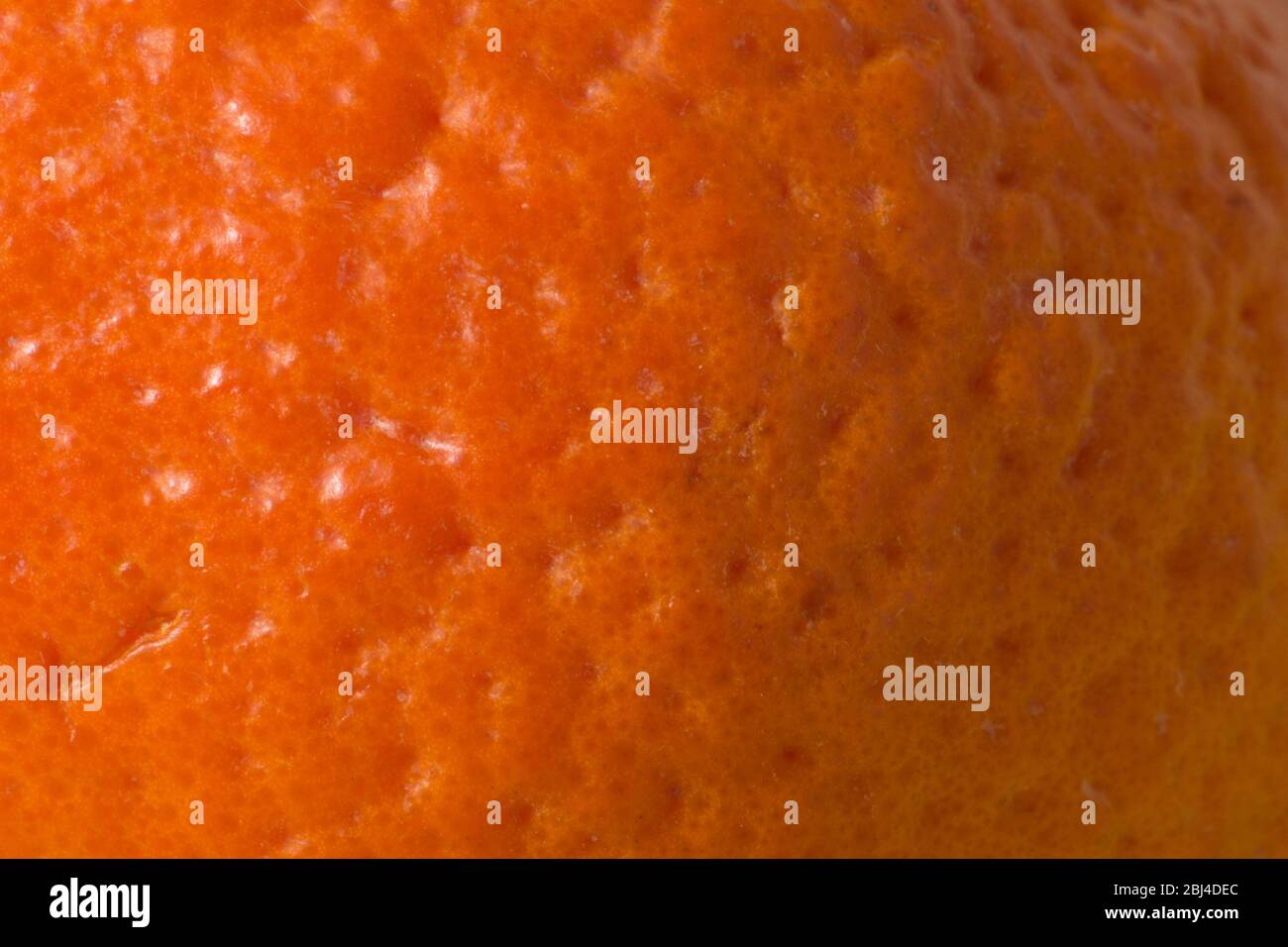 Cellulitis hi-res stock photography and images - Alamy