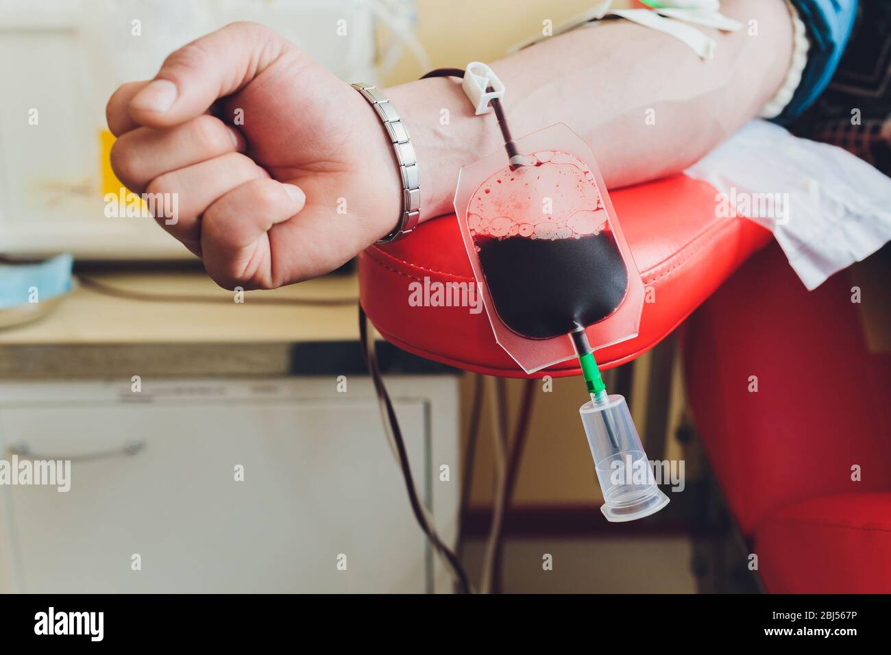 laboratory blood is removed during donation hand close-up Stock Photo ...