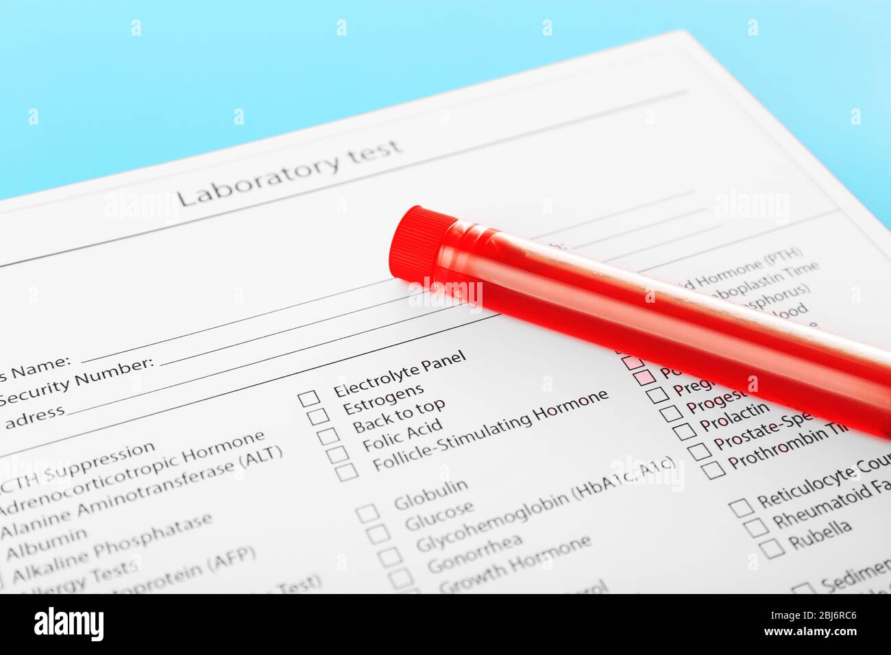 Blood in test tubes and investigation form on the table Stock Photo - Alamy