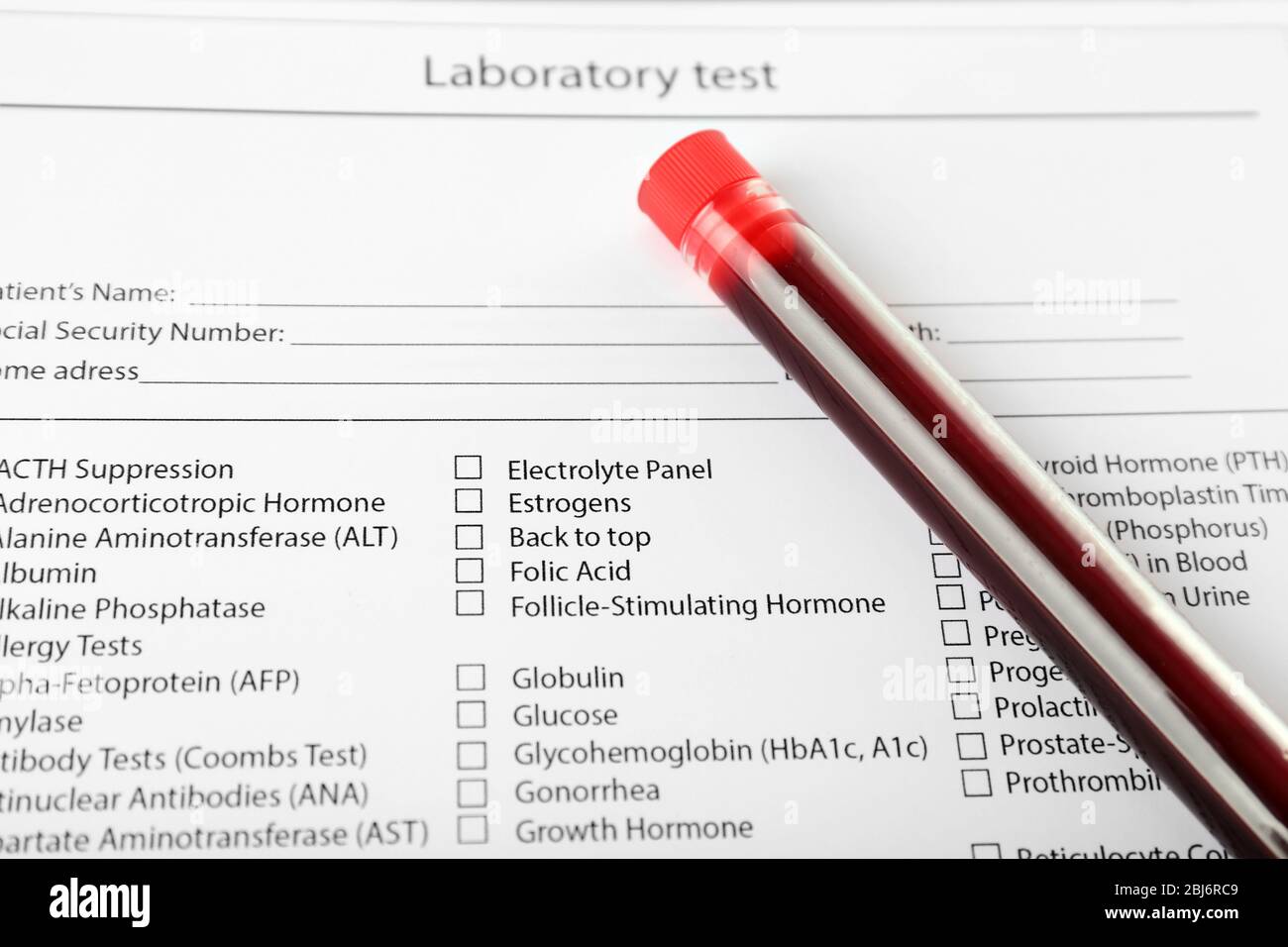 Blood in test tubes and investigation form on the table, close-up Stock ...