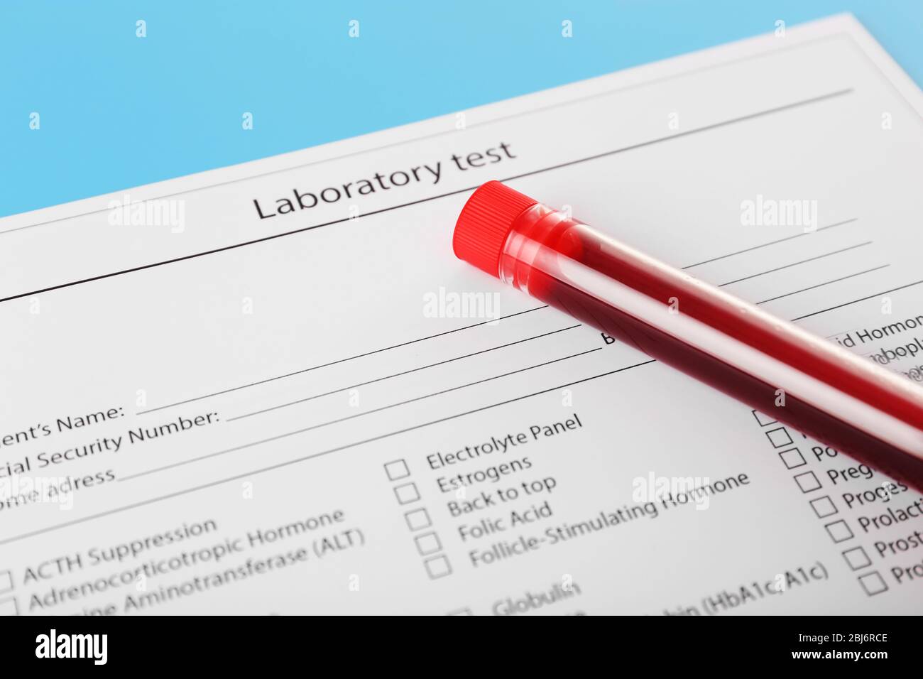 Blood in test tubes and investigation form on the table Stock Photo - Alamy