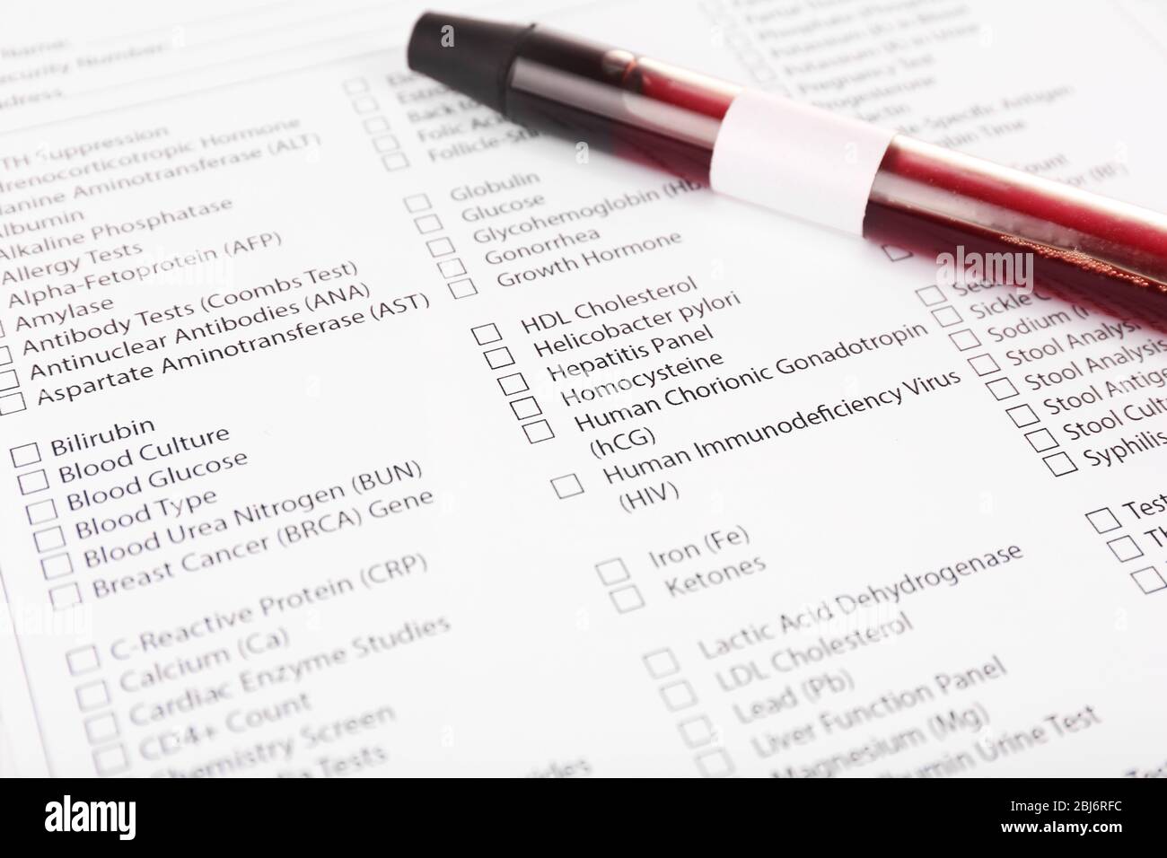 Blood in test tubes and investigation form on the table, close-up Stock ...