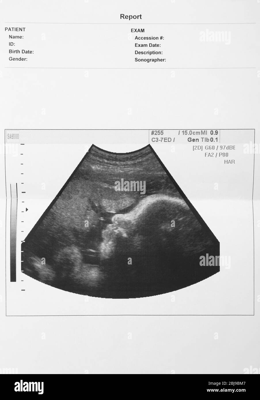 Sonogram Black and White Stock Photos & Images - Alamy