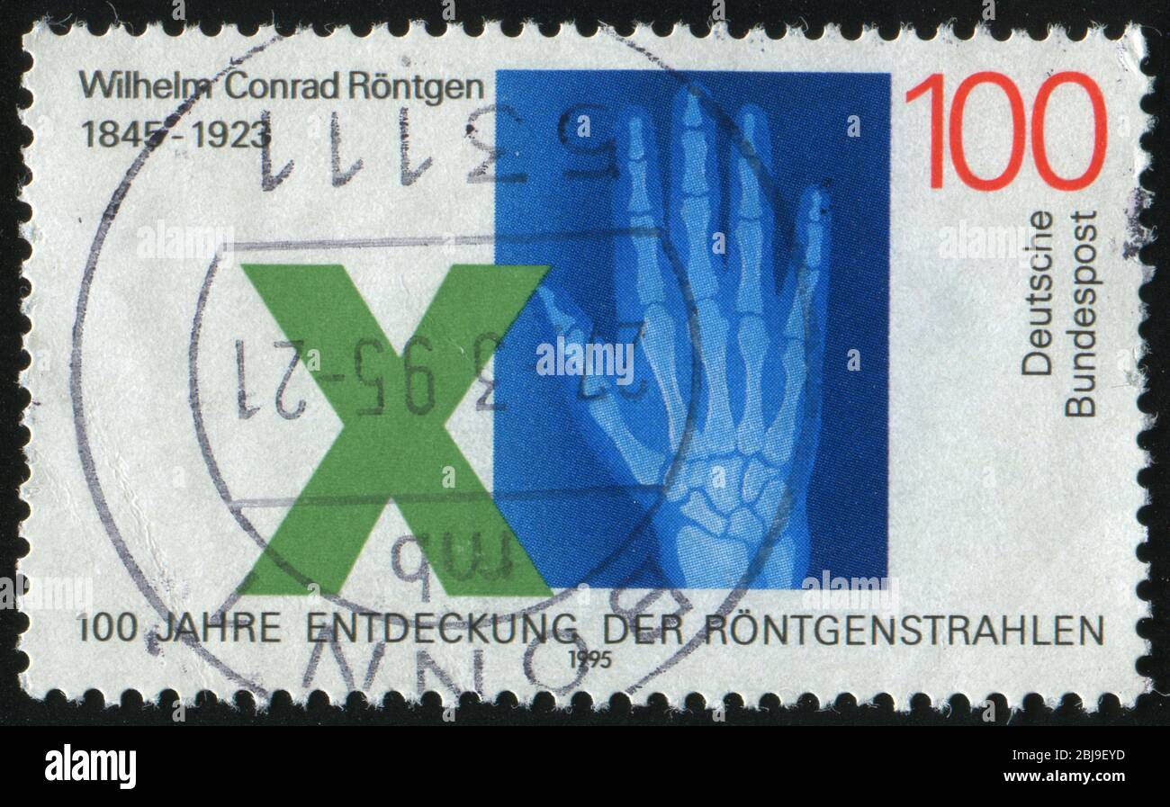 GERMANY- CIRCA 1995: stamp printed by Germany, shows Roentgen hand ...